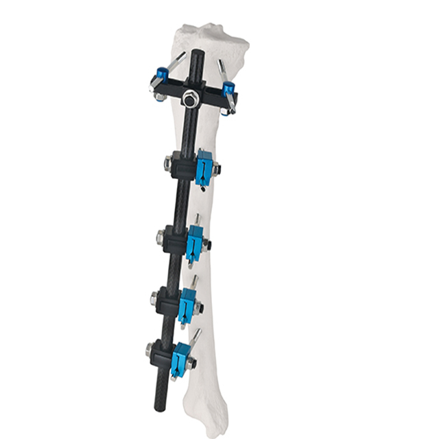 Orthopedic AO design Combinational T type External Fixators for tibia ...