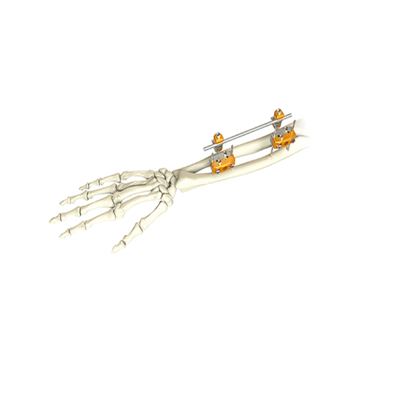 Jinlu Medical bone fracture orthopedic Forearm external fixator for ...