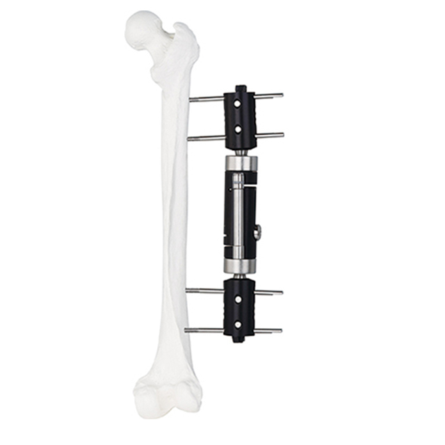 Orthofix Dynamic axialExternal Fixators（Straight type）forOrthopedic ...