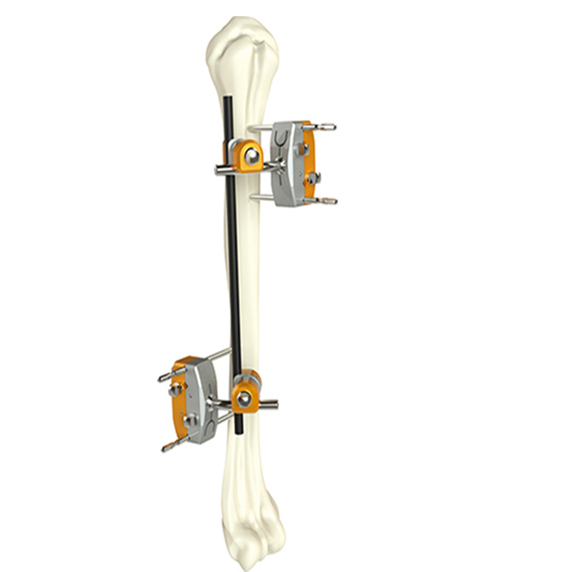 China Combinational External Fixators manufacturers, Combinational ...