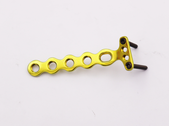 China Orthopedic Implants Distal Radius Lateral Volar Joint Locking
