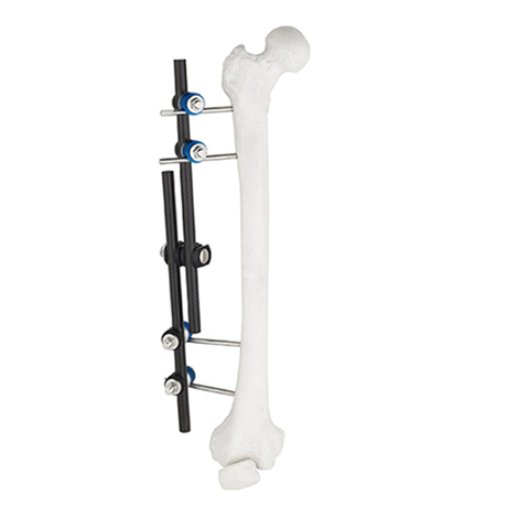 Provide you with professional orthopaedic implants, orthopaedic ...