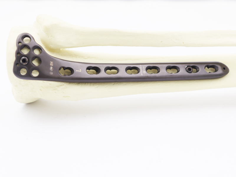 Orthopedic surgical Implants Proximal Tibial Lateral Locking plate for ...