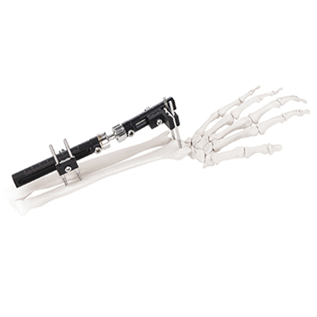 Orthofix Wrist External Fixators（L type） for Orthopedic Fixation from ...