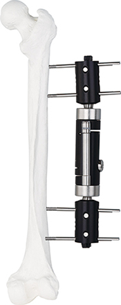 Orthofix Dynamic axialExternal Fixators（Straight type）forOrthopedic ...