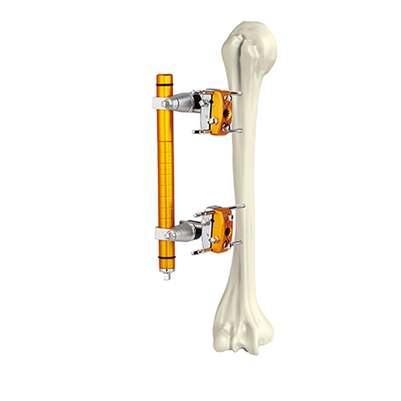 Jinlu Medical orthopedic humerus external fixator for bone shaft and ...