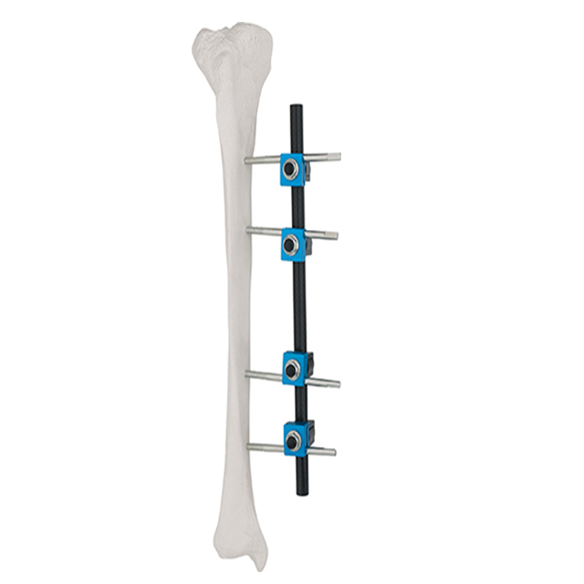 Orthopedic AO Design Combinational Straignt Type External Fixators for ...