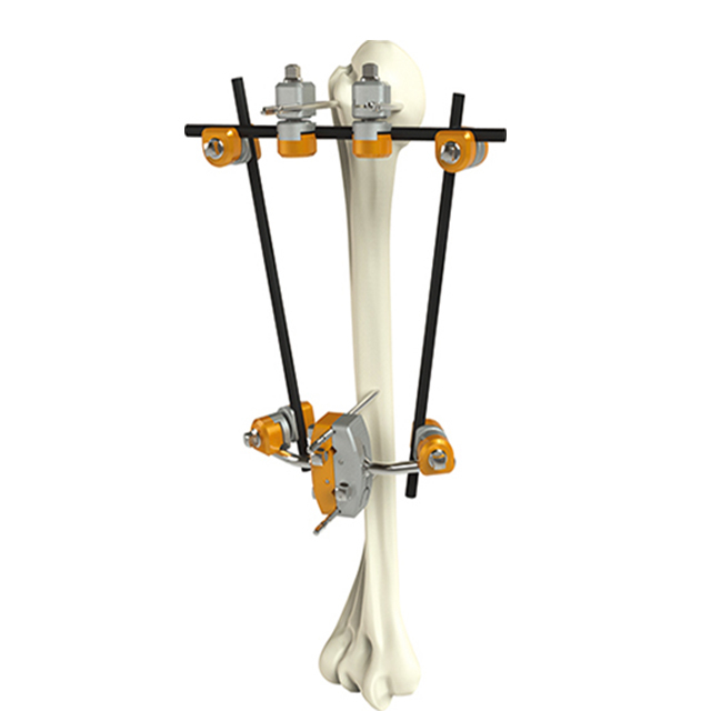 China Combinational External Fixators manufacturers, Combinational ...