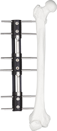 Orthofix Limb reconstruction external fixator A type for Orthopedic ...
