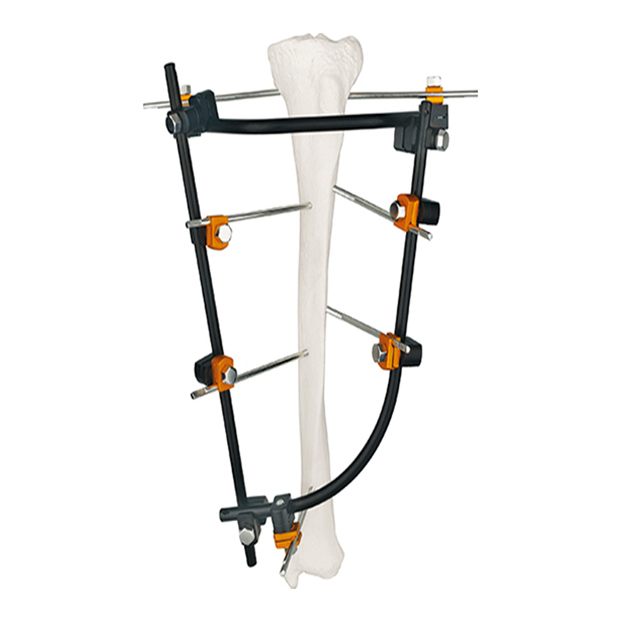 AO Design Combinational Tibial Joint Side External Fixators for ...