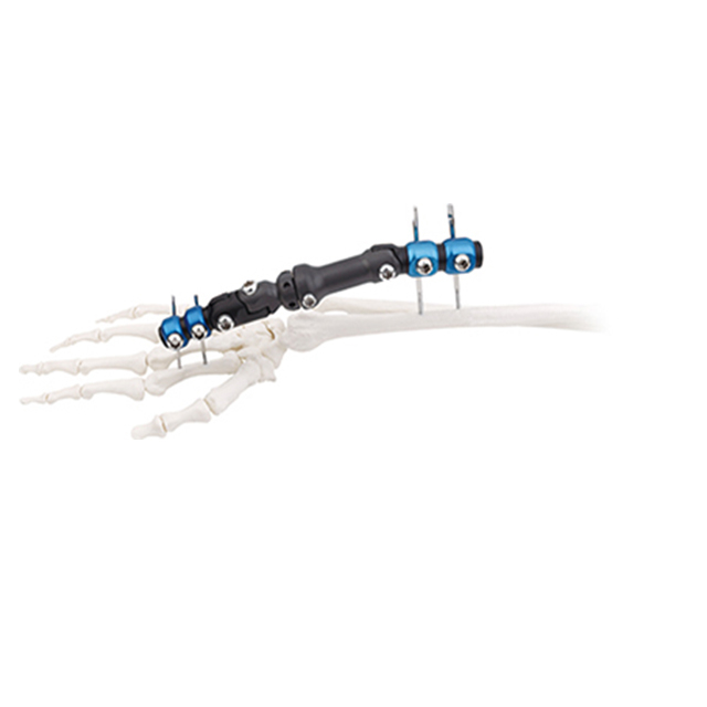 Orthofix Wrist External Fixators (Radiolucent Multi-joint Type) for ...